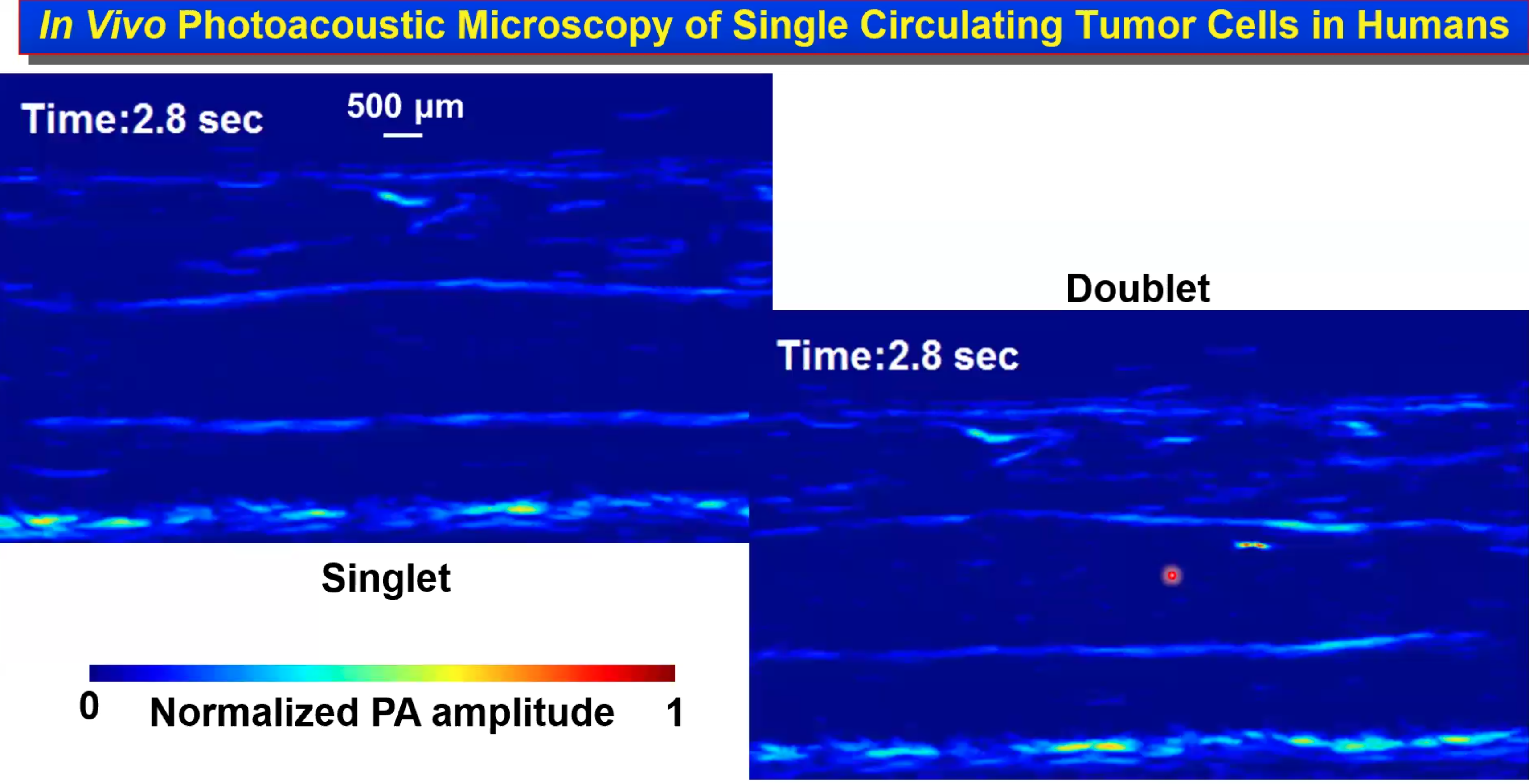 The 5th Yungu Lectureship: Photoacoustics, Lightspeed, and Quantum Imaging